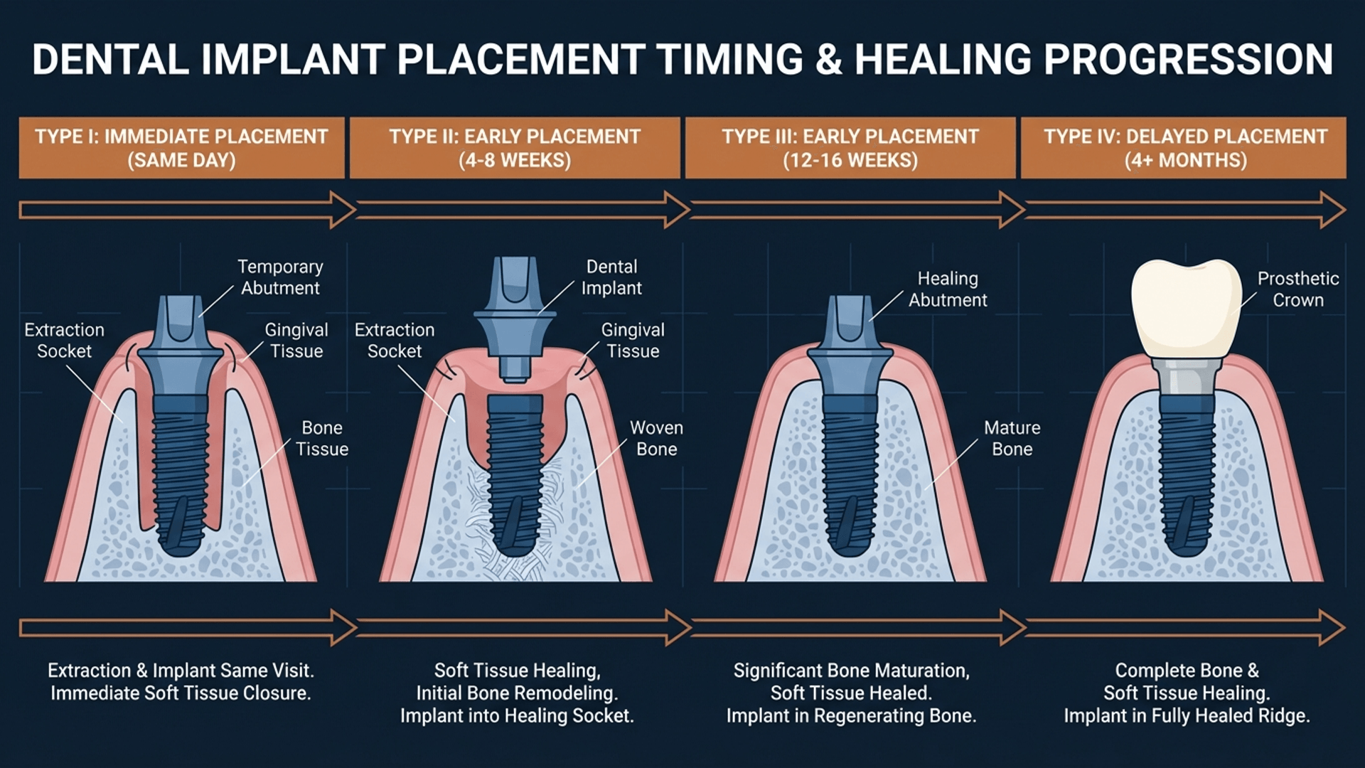 Immediate Implant Placement: 2025 Evidence-Based Guide | Periospot