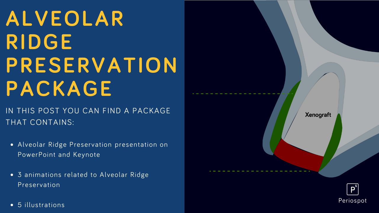 Alveolar Ridge Preservation Package | Periospot