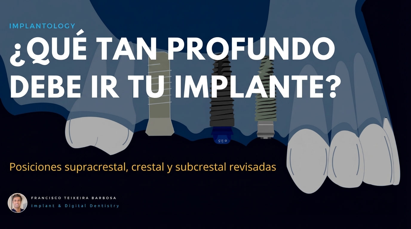 ¿Qué tan profundo debe ir tu implante? Posiciones supracrestal, crestal ...
